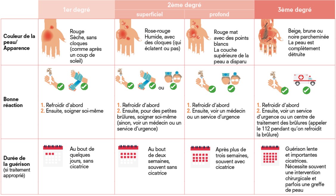 Comment soigner les brûlures? - Test Achats