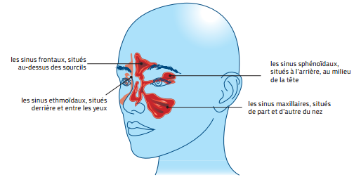 Quels sont les symptômes quand on a une sinusite ? - Test Achats